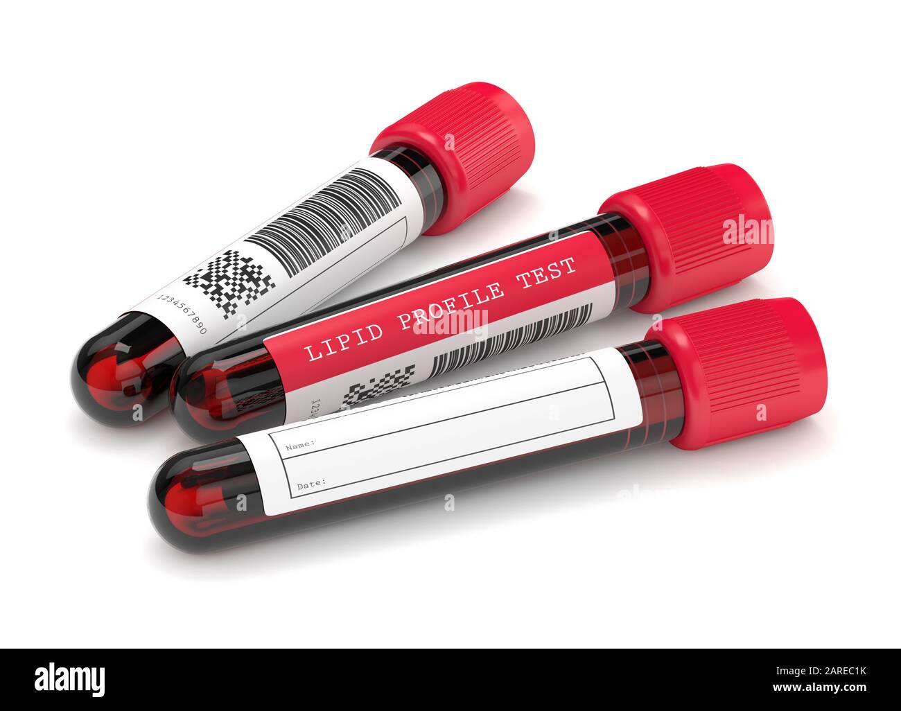 3d render with lipid profile test blood samples over white background ...
