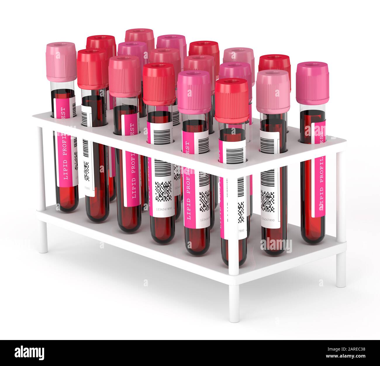 3d render with lipid profile test blood samples in rack over white ...