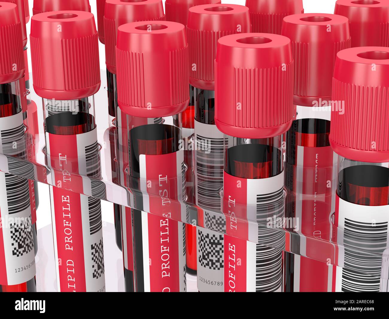 3d render with lipid profile test blood samples in rack Stock Photo - Alamy