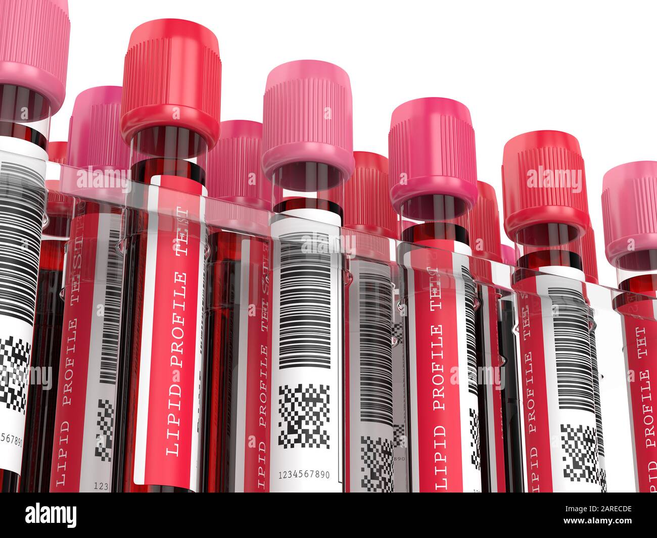 Lipid profile hi-res stock photography and images - Alamy