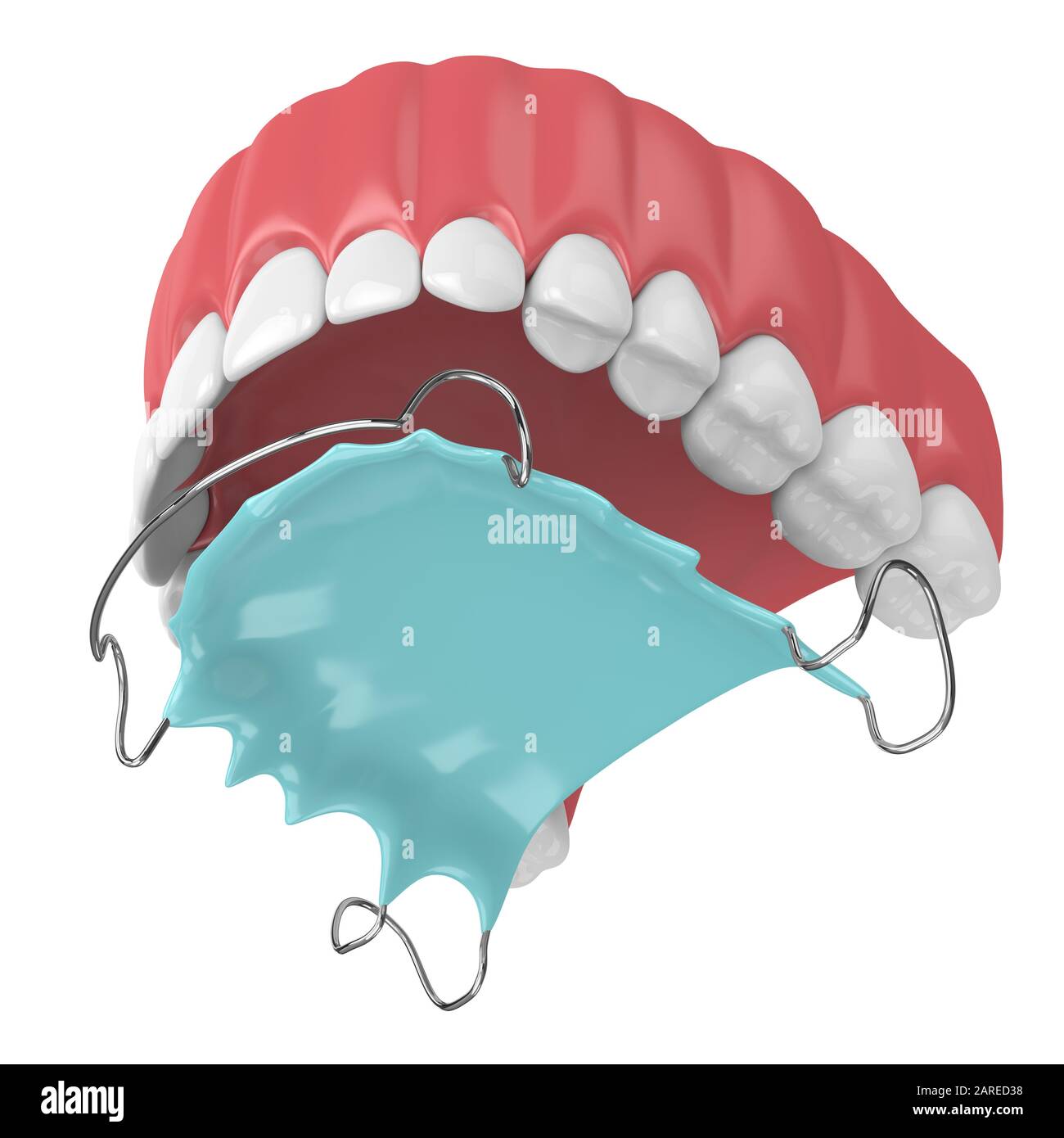 3d render of jaw with orthodontic removable retainer over whte ...
