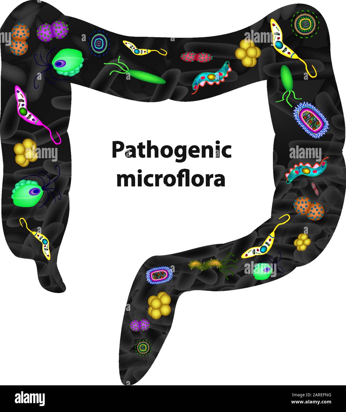 Pathogenic microflora in the intestine. Dysbacteriosis. Dysbiosis ...