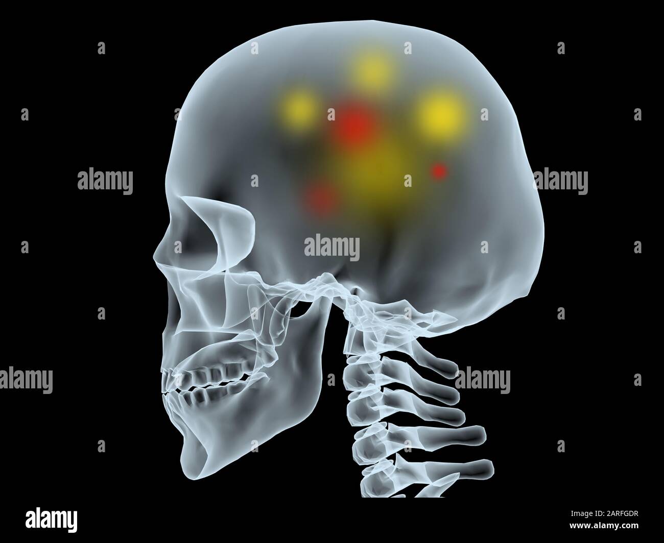 Head xray hi-res stock photography and images - Alamy
