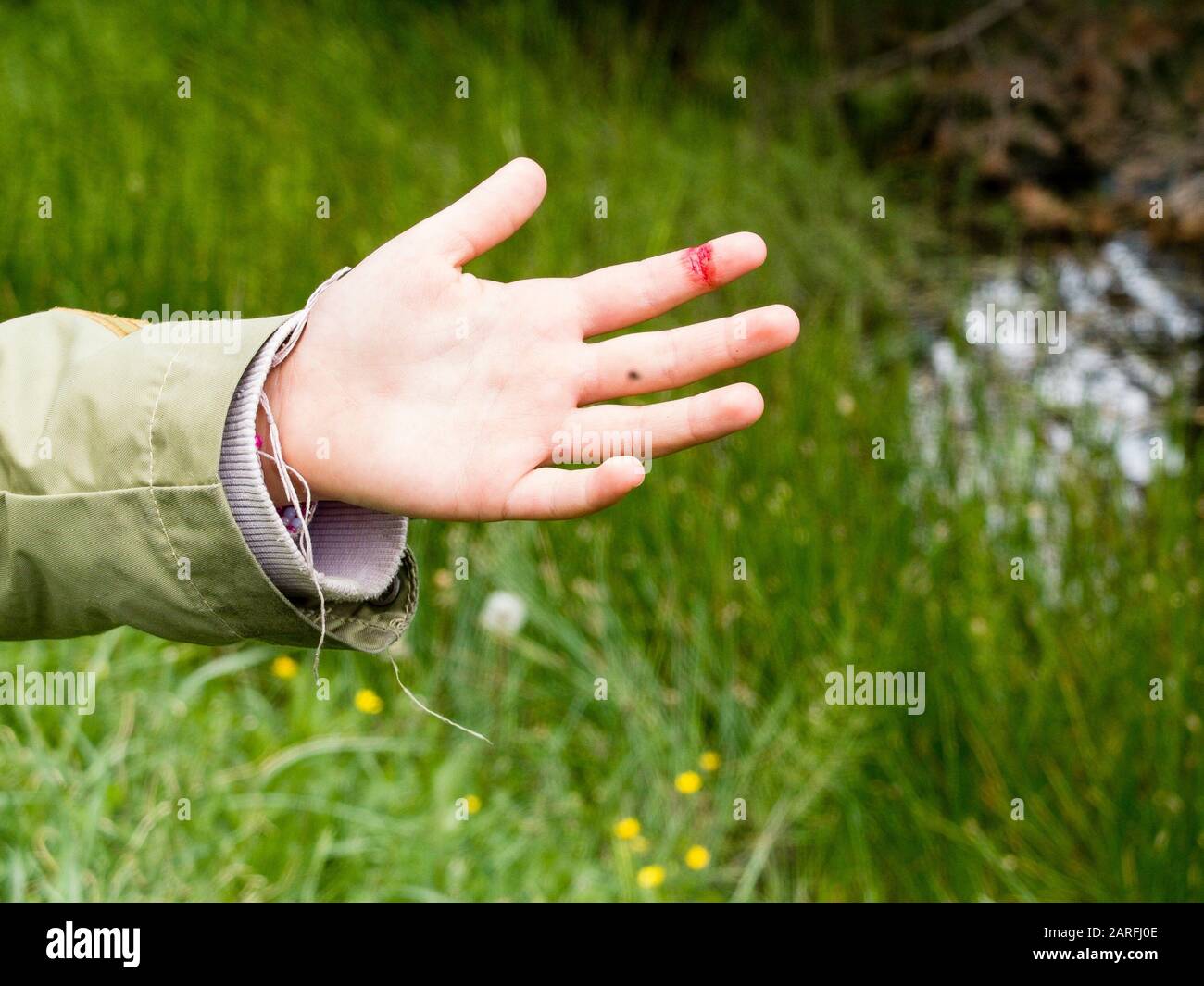 Child showing finger cut hi-res stock photography and images - Alamy