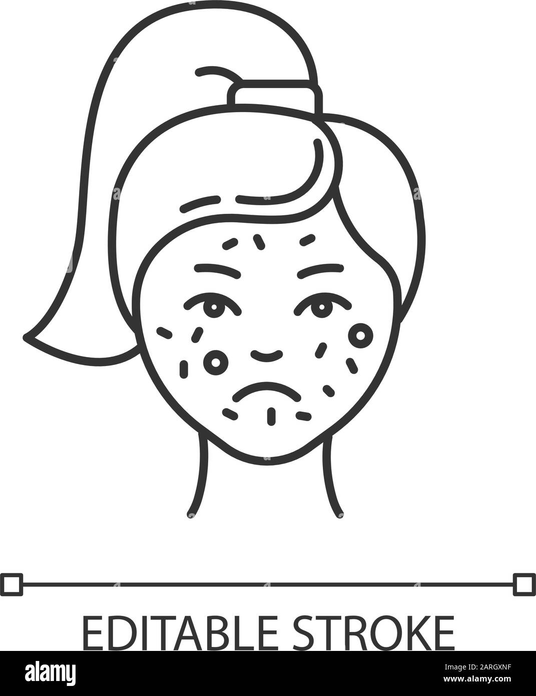 Acne vector vectors hi-res stock photography and images - Alamy