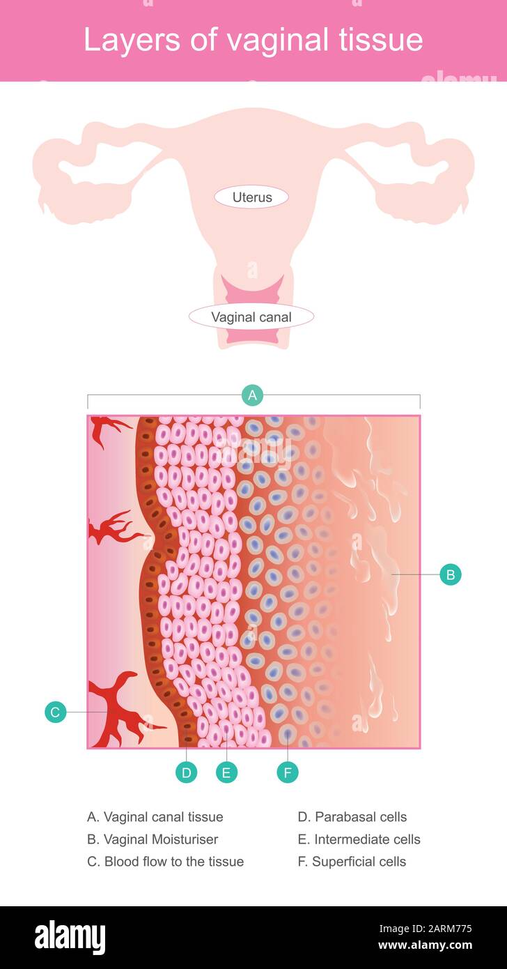 Layers of vaginal tissue. Vaginal walls is elastic tissue layers thick ...