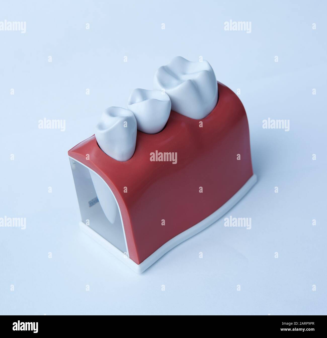 Implant model hi-res stock photography and images - Alamy
