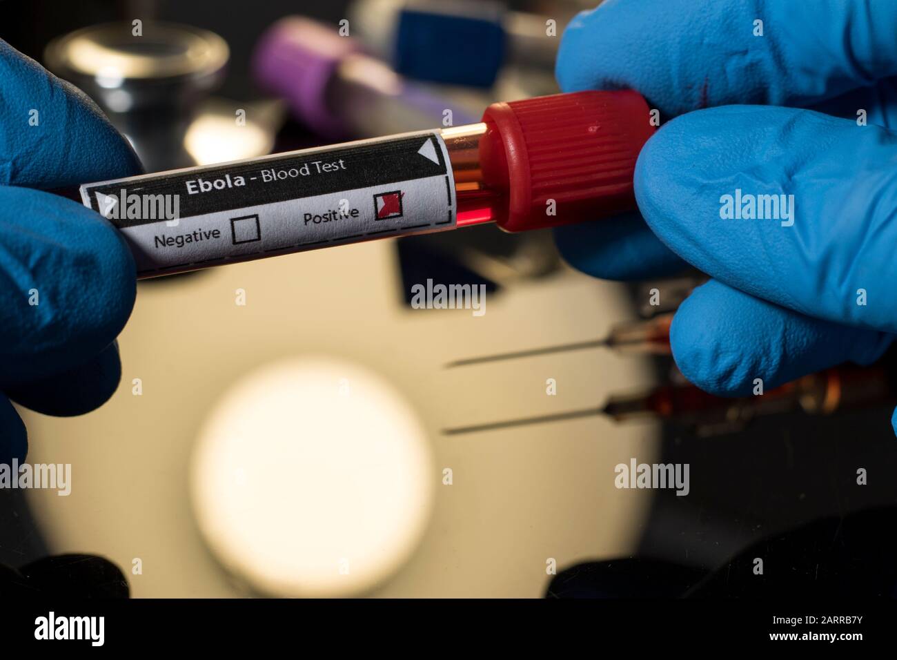 Ebola virus blood sample test positive for infections symptoms ...