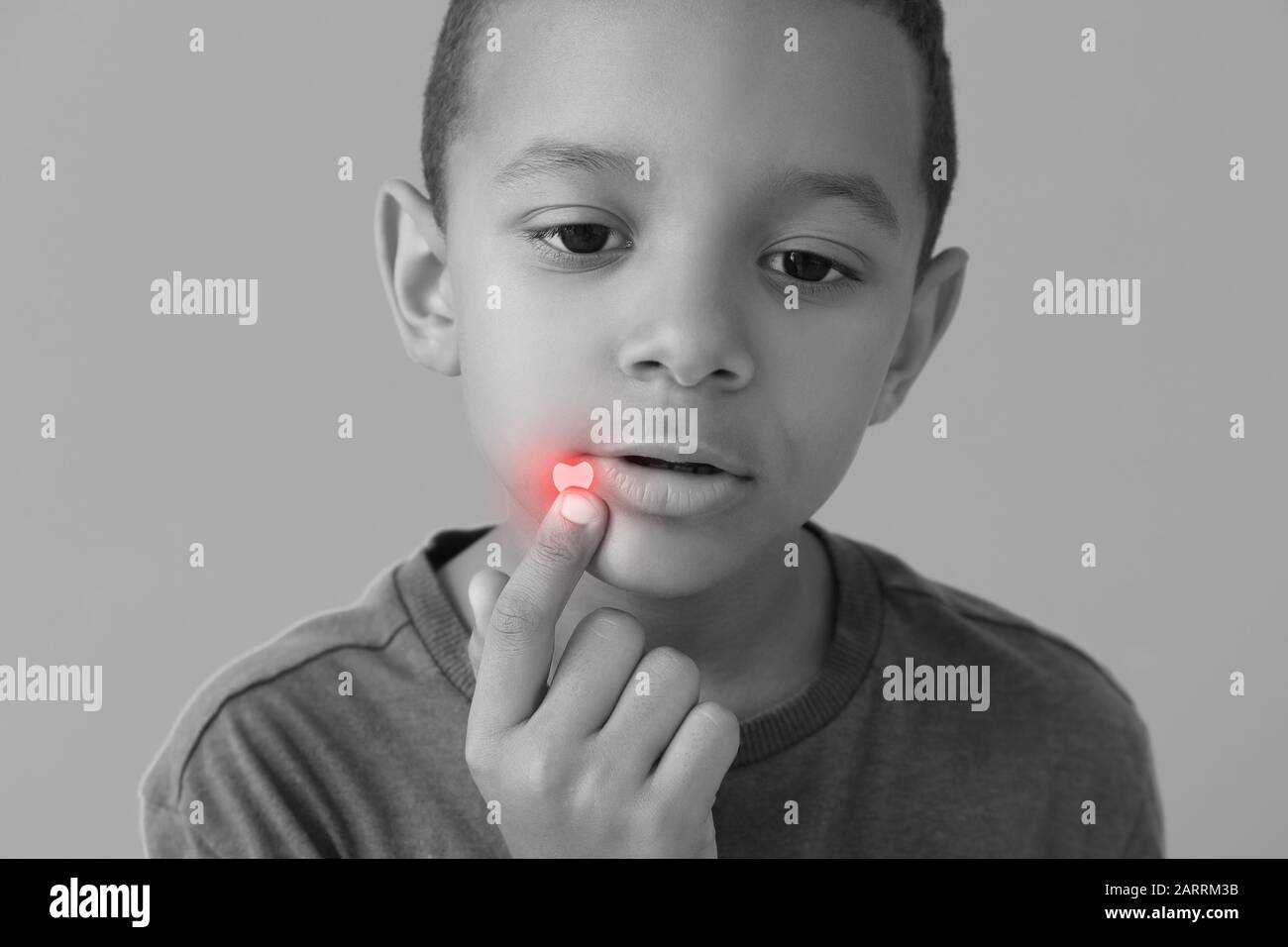 Black and white photo of little African-American boy suffering from ...