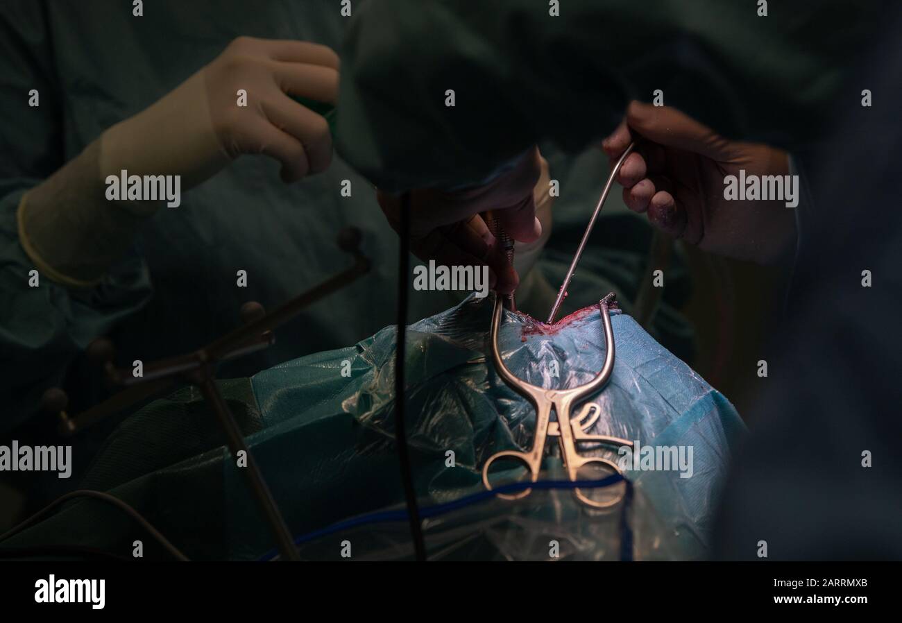 20 January 2020, Baden-Wuerttemberg, ---: A doctor operates on the open ...