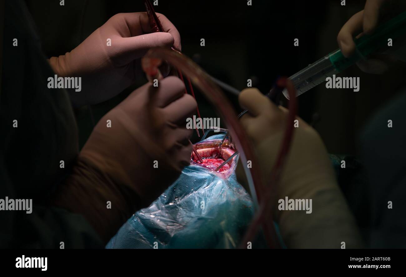 Germany. 20th Jan, 2020. A doctor operates on the open skull of a ...