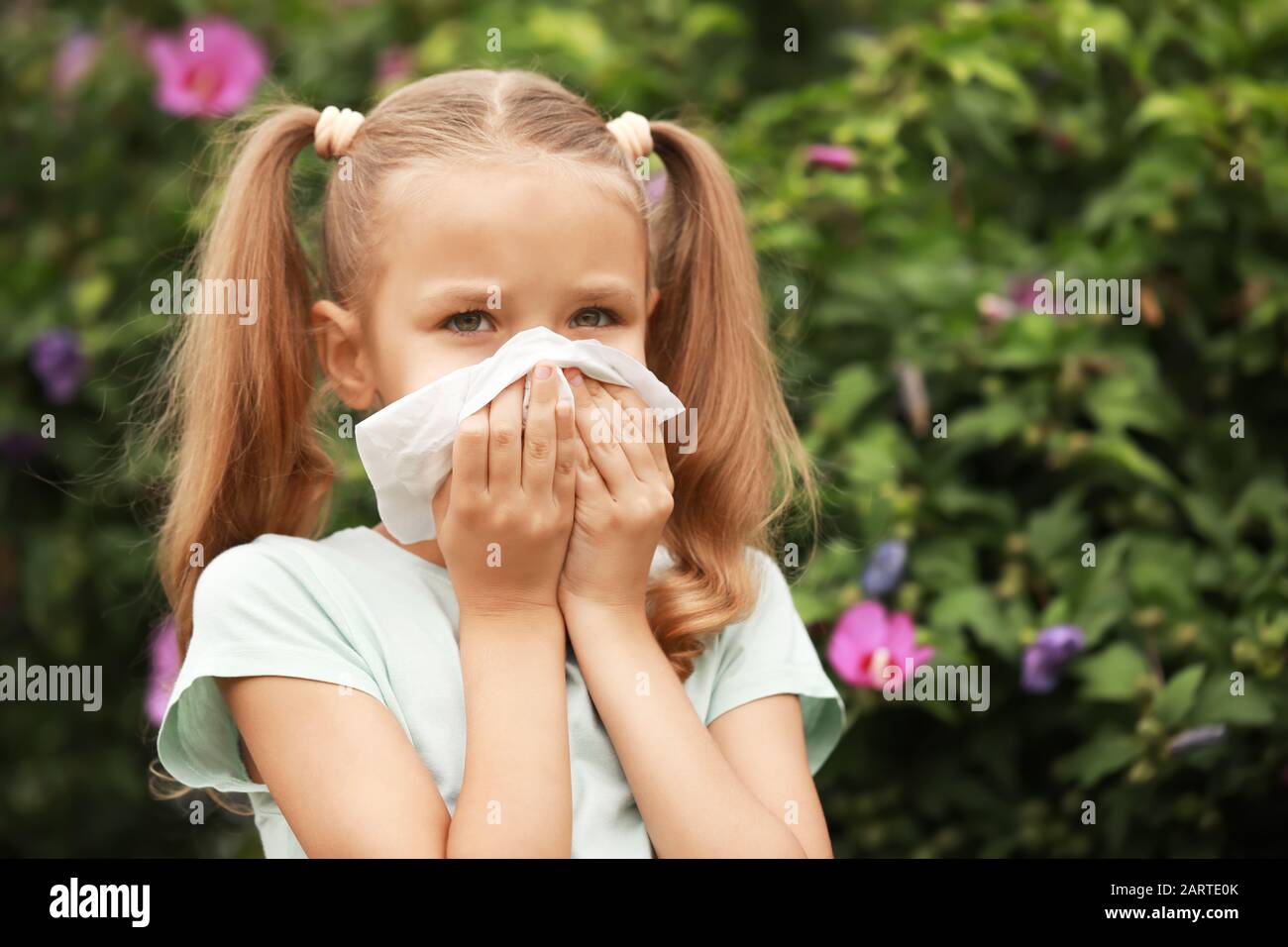 Little girl suffering from allergy outdoors Stock Photo - Alamy