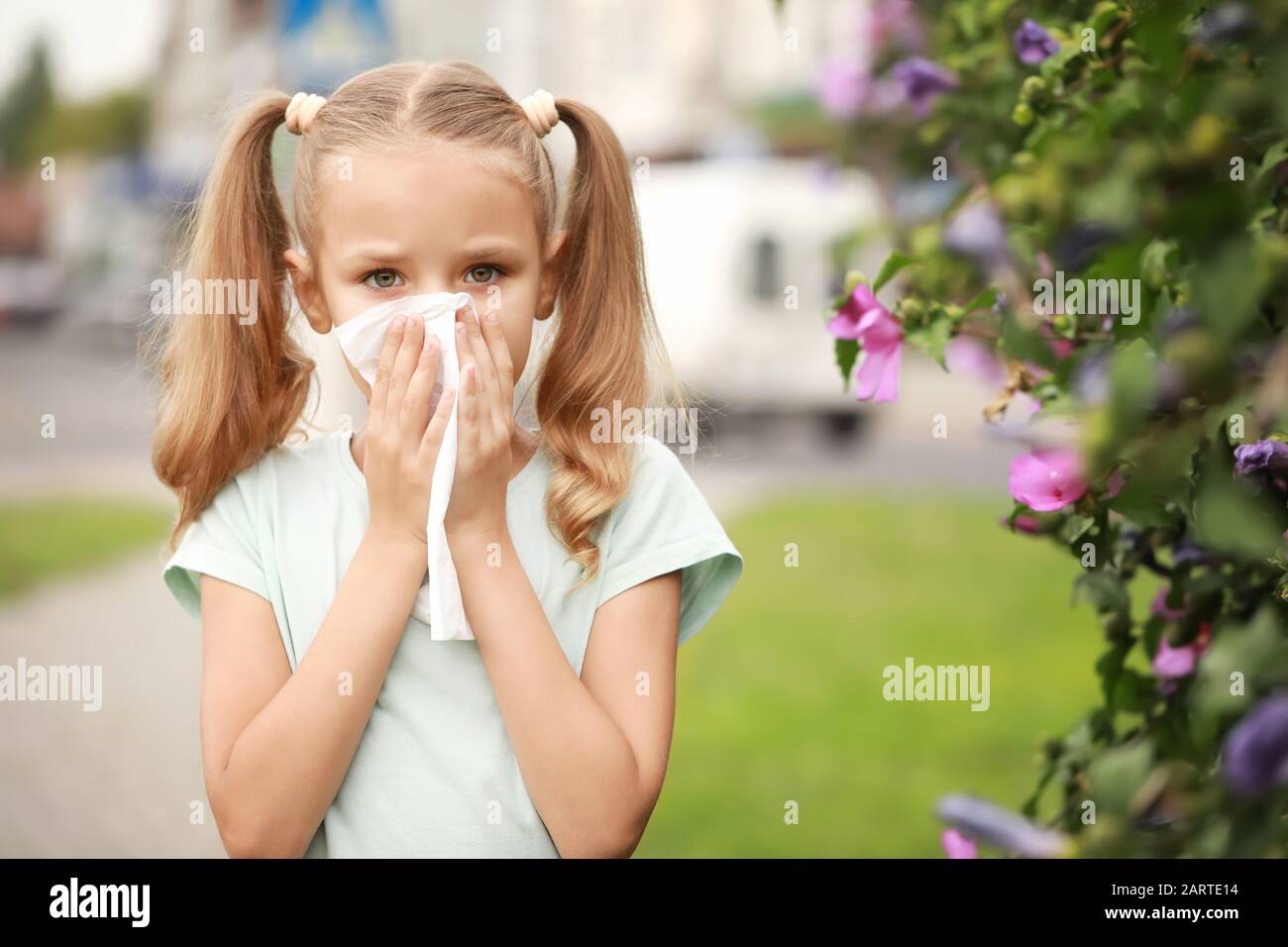Little girl suffering from allergy outdoors Stock Photo - Alamy
