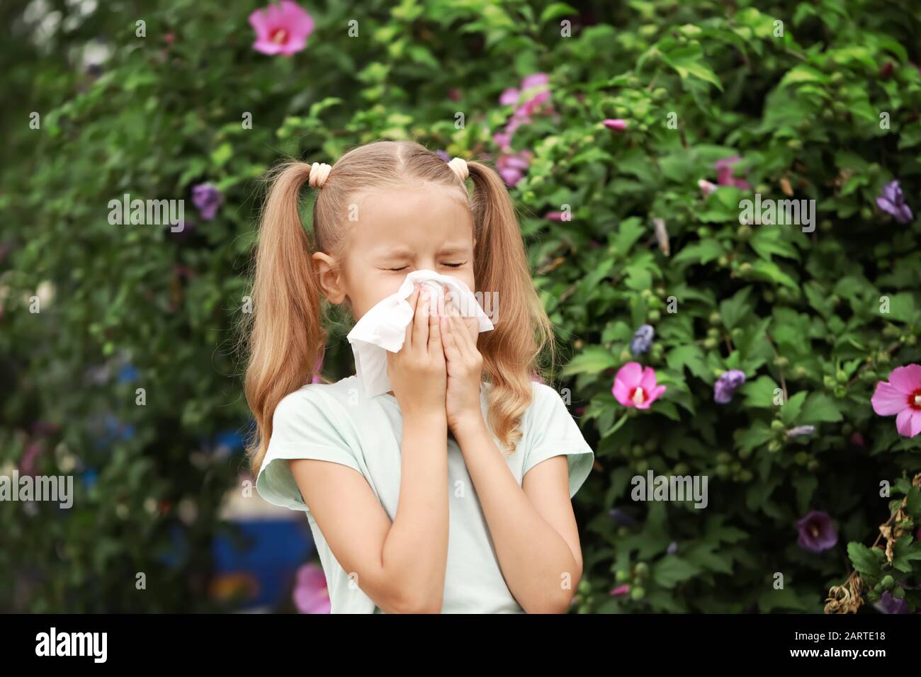 Little girl suffering from allergy outdoors Stock Photo - Alamy