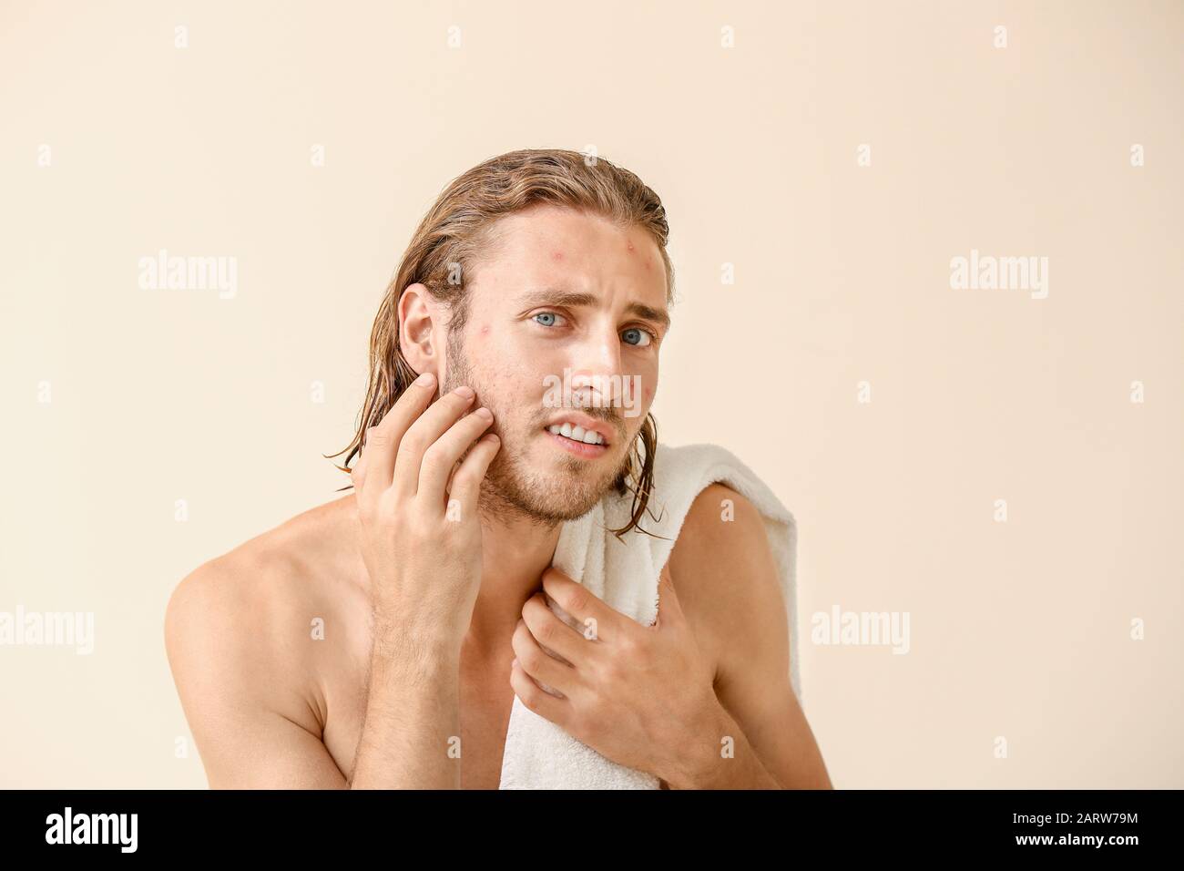 Adult acne man hi-res stock photography and images - Alamy