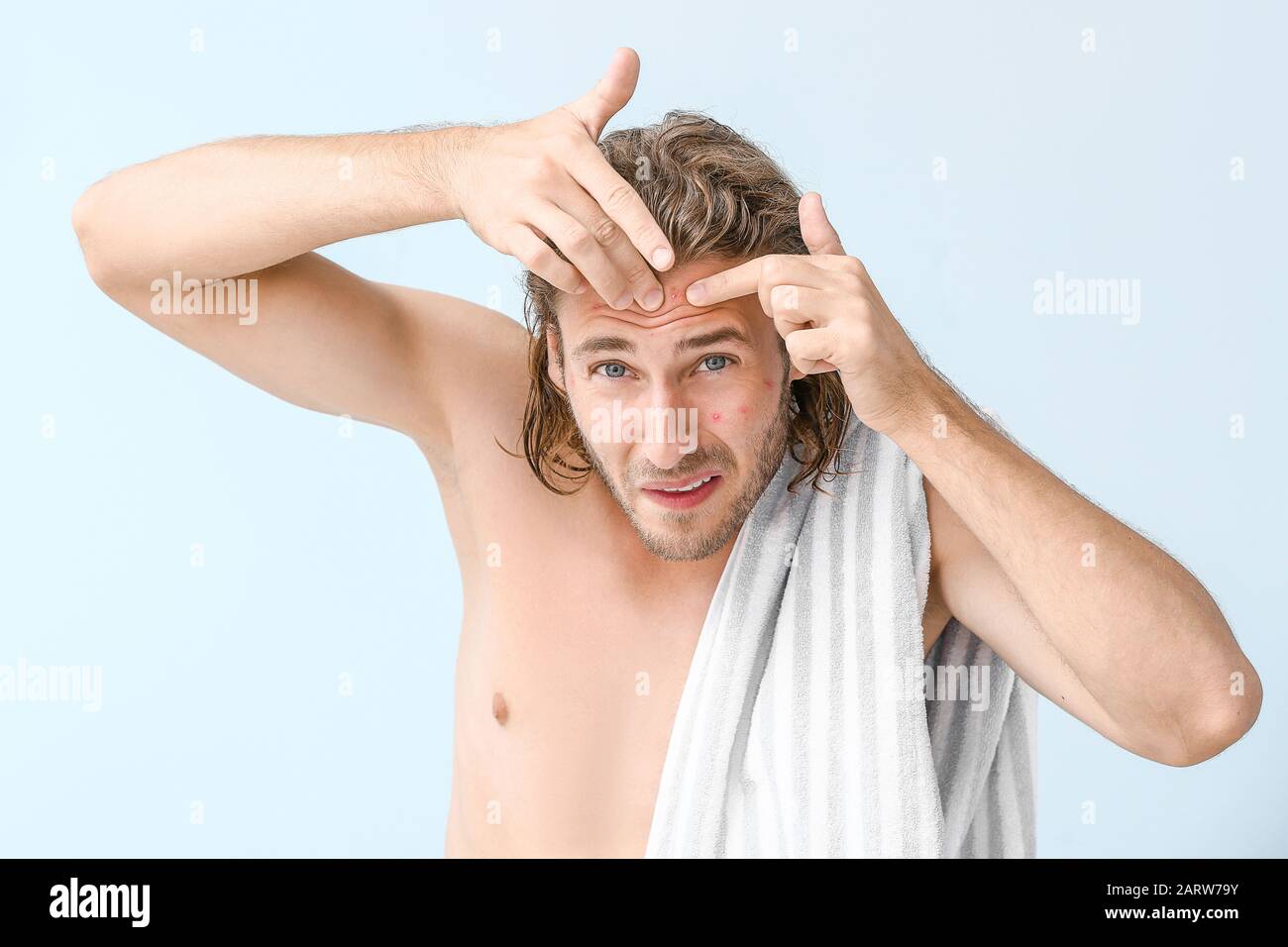 Portrait Of Young Man With Acne Problem Squishing Pimples On Color