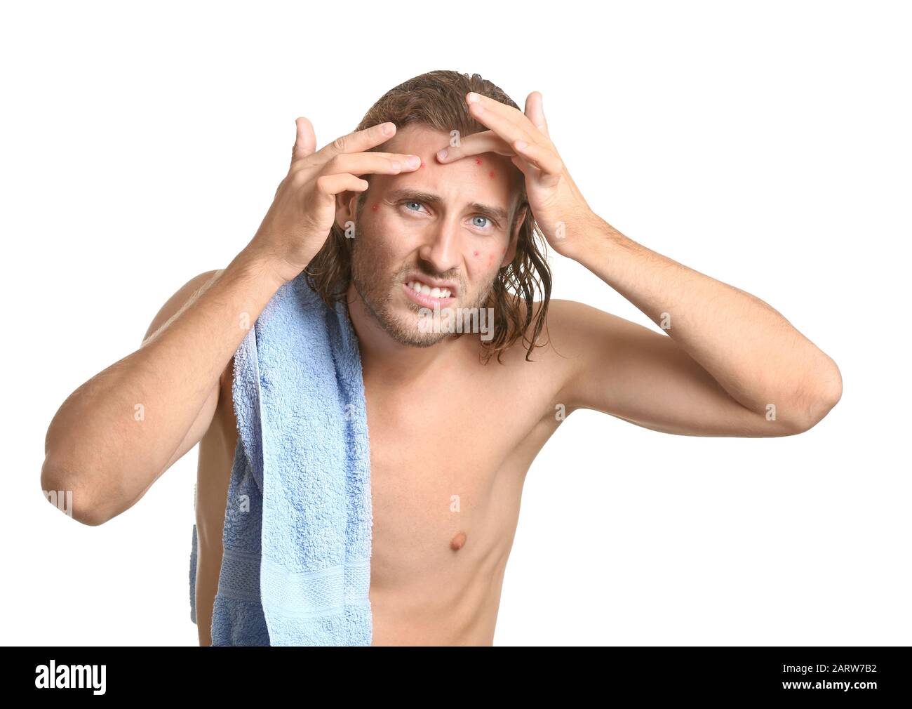 Portrait Of Young Man With Acne Problem Squishing Pimples On White