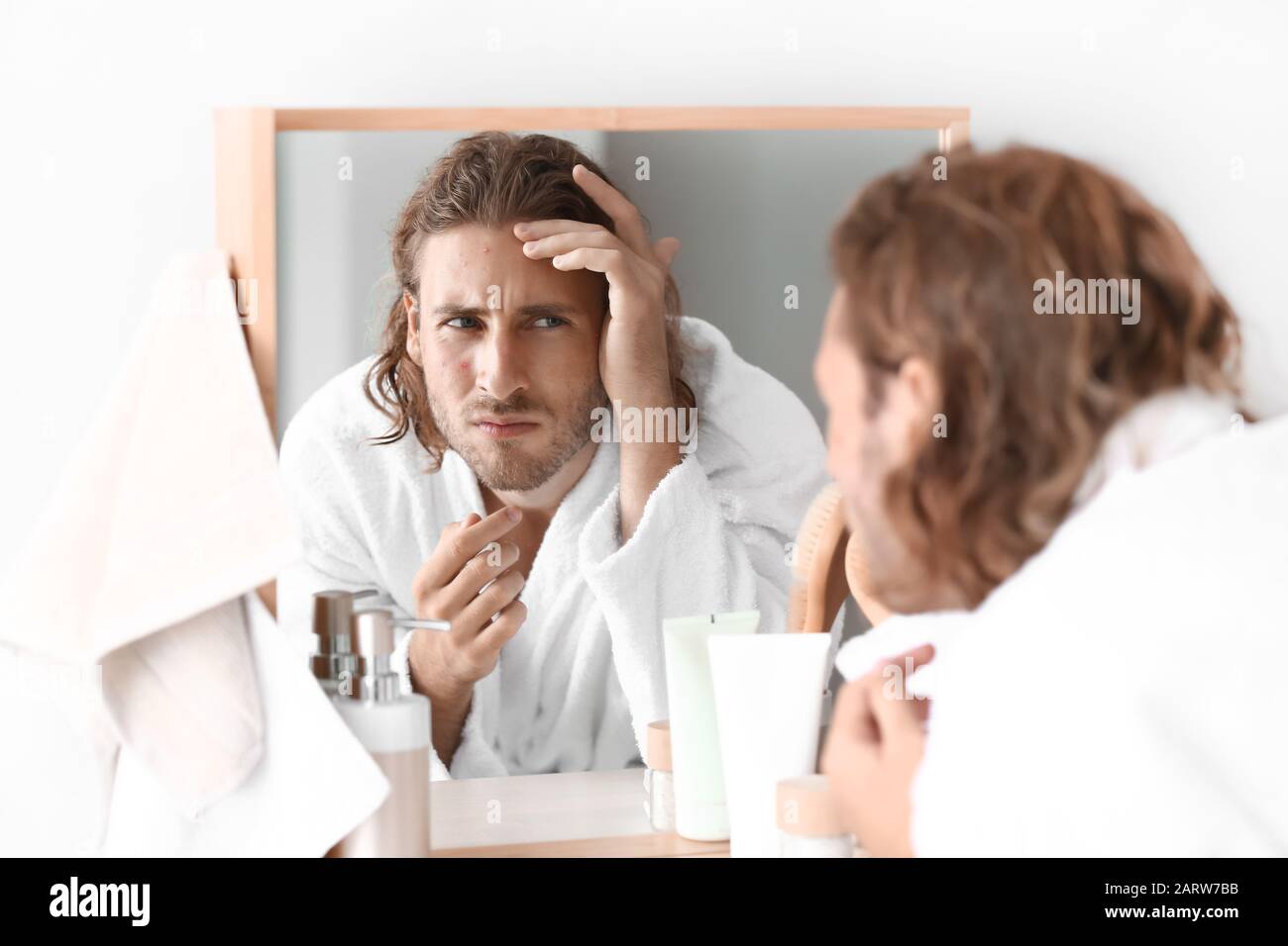 Young man acne problem near hi-res stock photography and images - Alamy