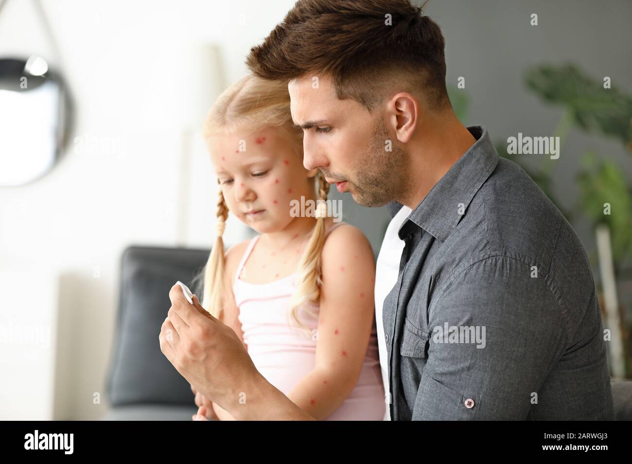 Man measuring temperature of his little daughter ill with chickenpox at ...
