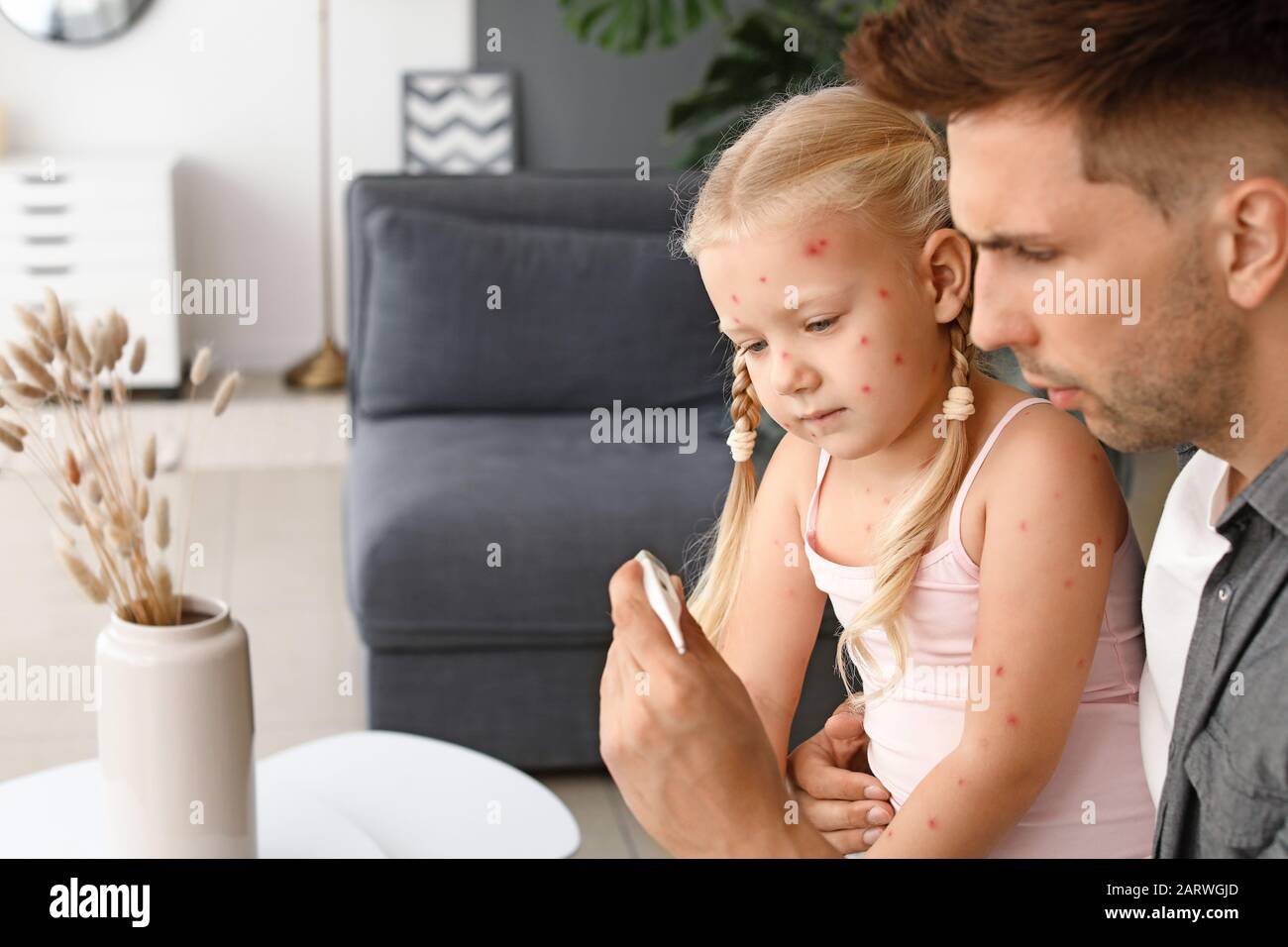 Child chicken pox thermometer hi-res stock photography and images - Alamy
