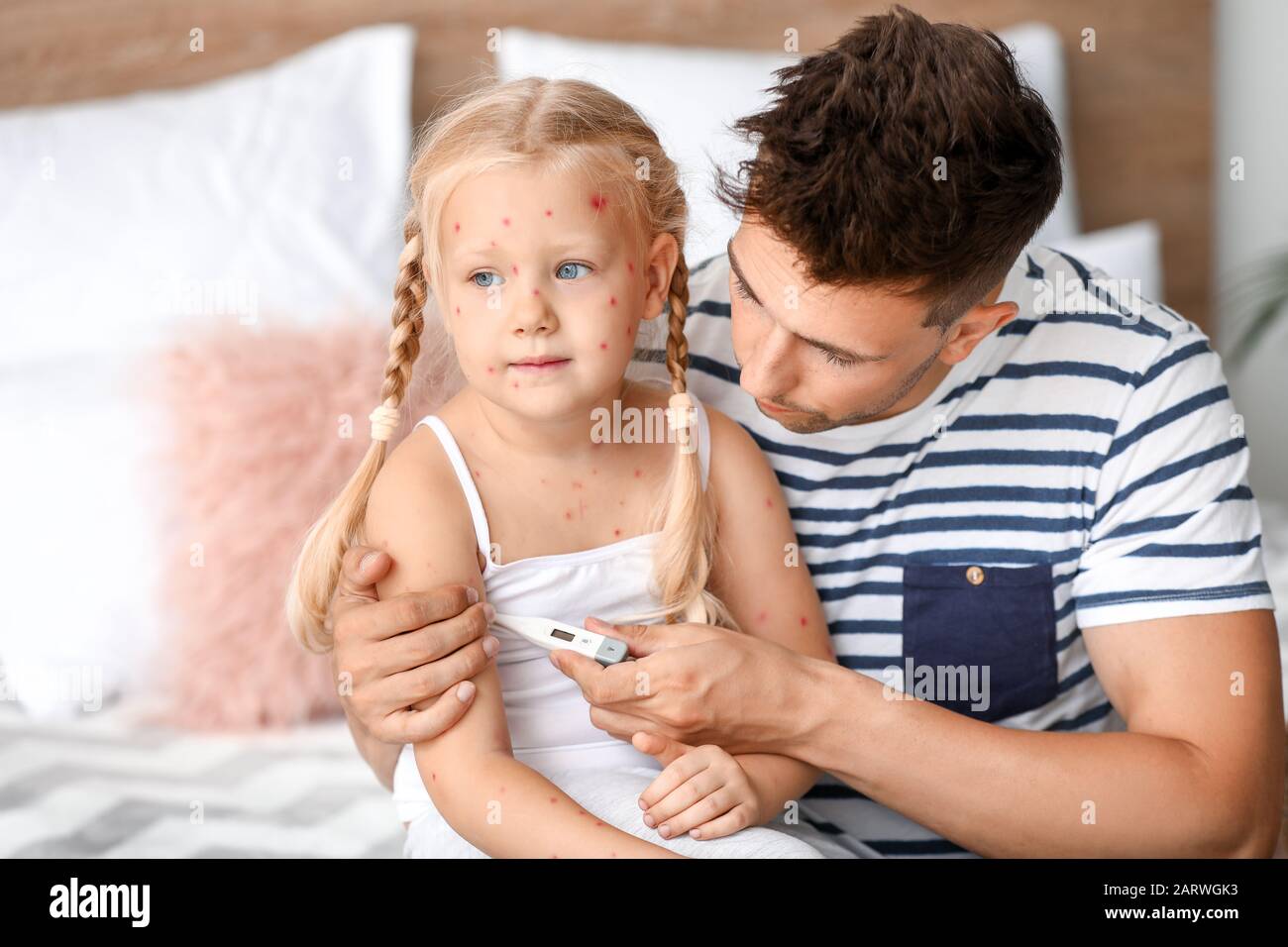 Chicken pox adult hi-res stock photography and images - Alamy