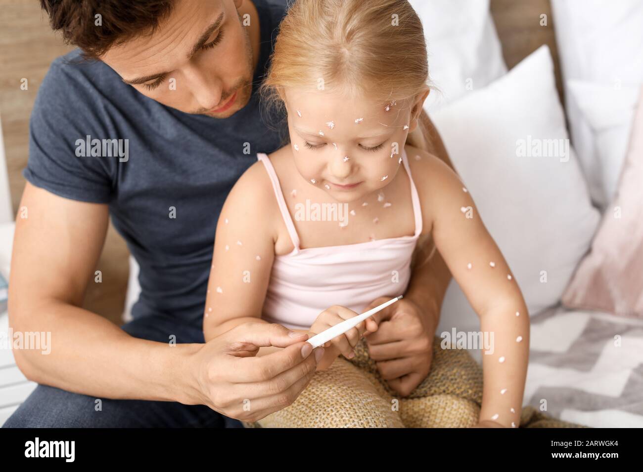 Chicken Pox Adult High Resolution Stock Photography and Images - Alamy