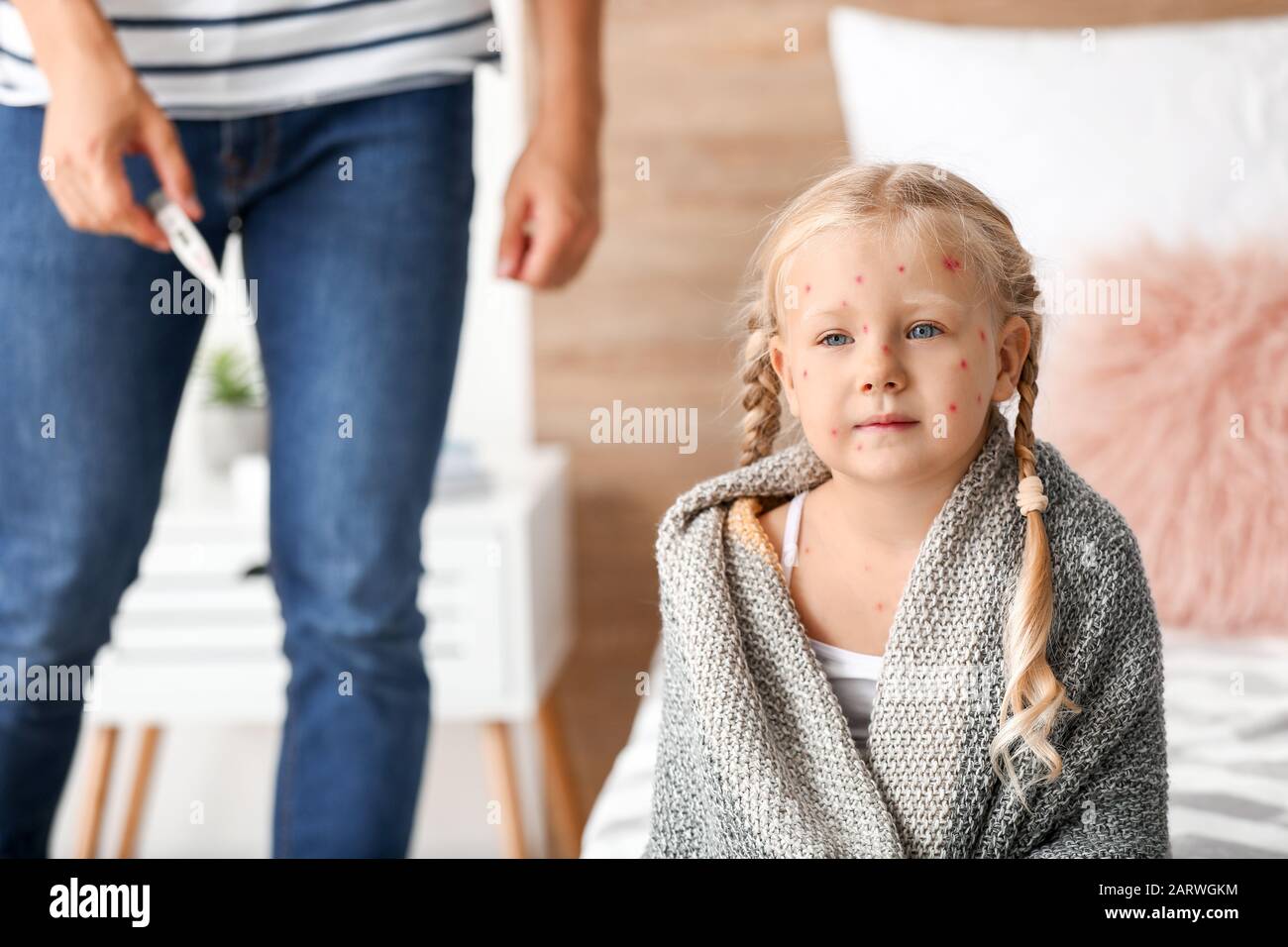 Child chicken pox thermometer hi-res stock photography and images - Alamy