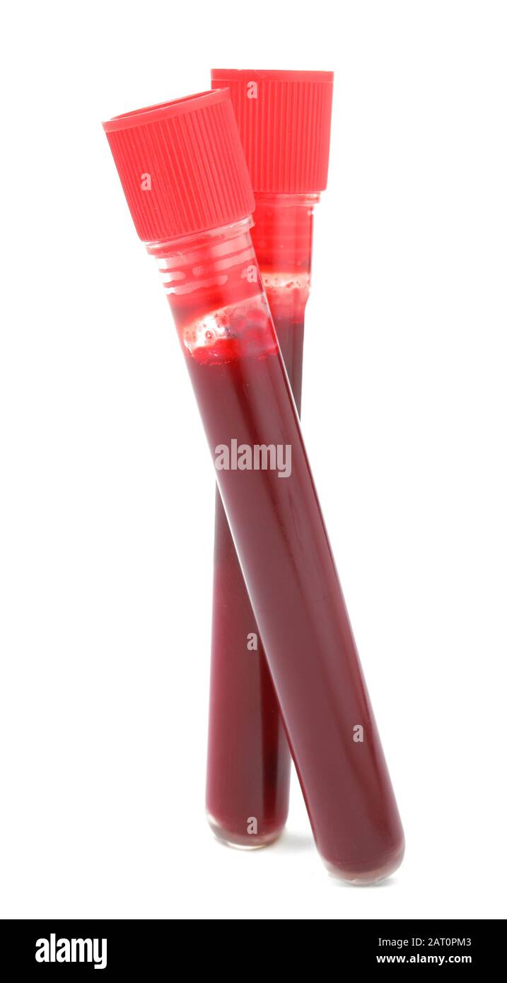 Blood analysis results Cut Out Stock Images & Pictures - Alamy