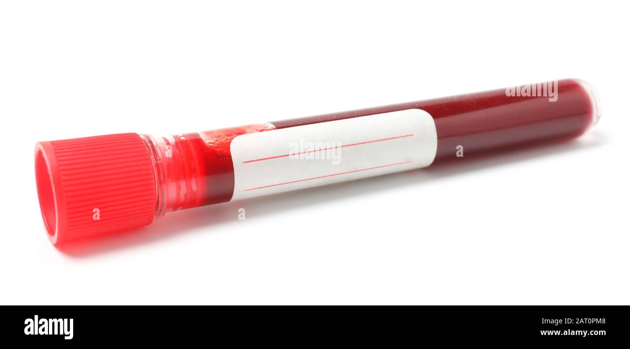 Blood analysis results Cut Out Stock Images & Pictures - Alamy