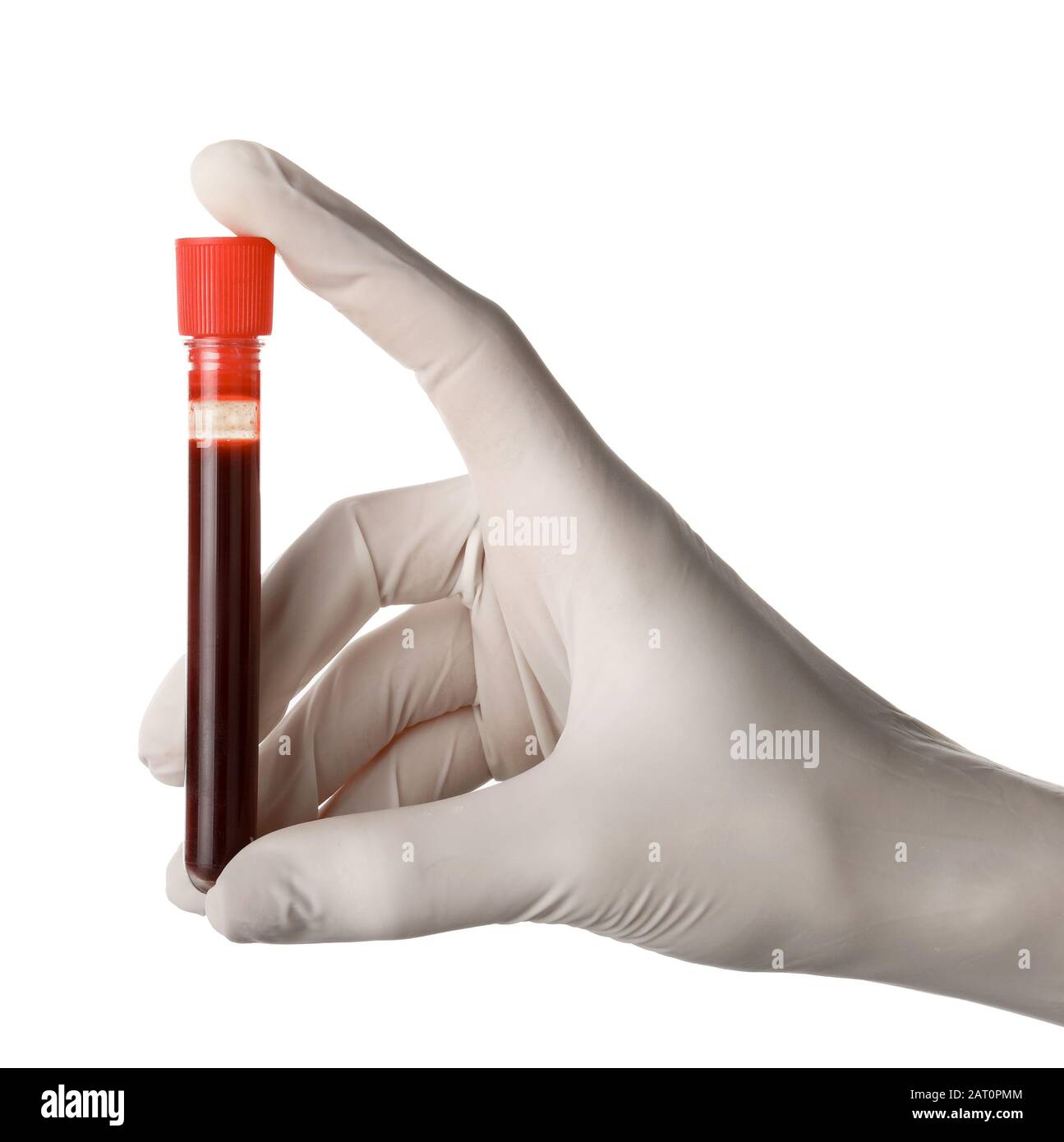 Doctor's hand holding test tube with blood on white background Stock ...