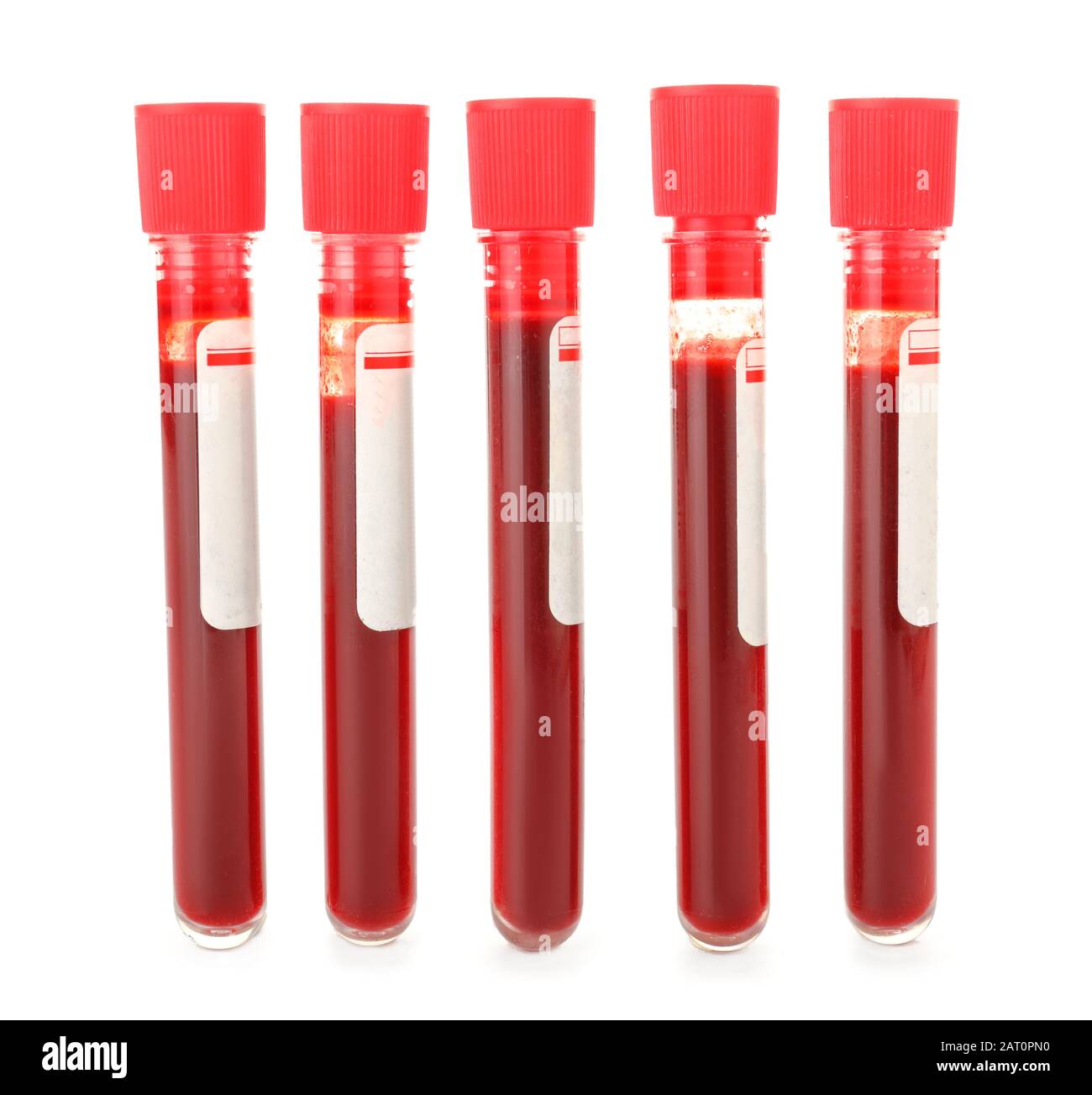 Test tubes with blood on white background Stock Photo - Alamy