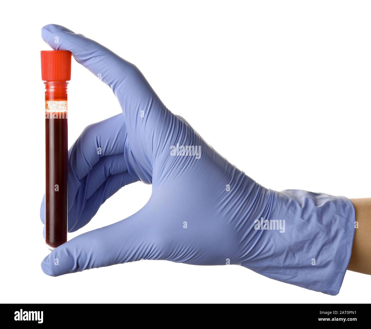 Doctor's hand holding test tube with blood on white background Stock ...