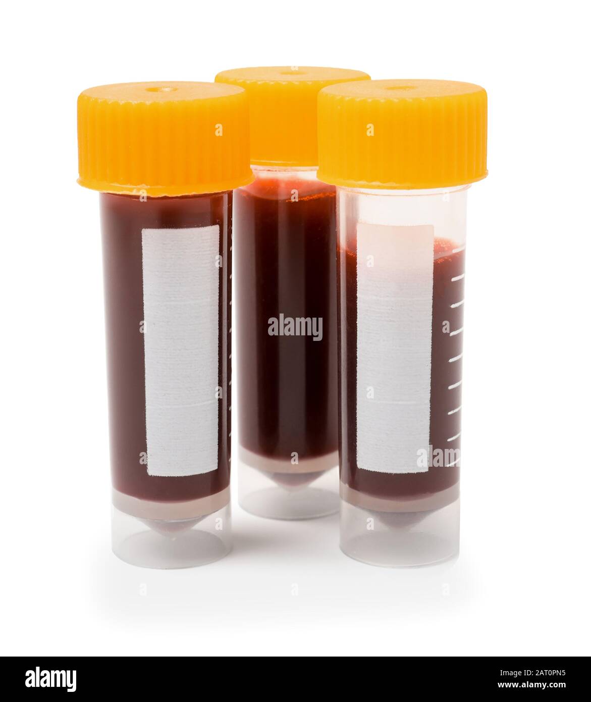 Blood analysis results Cut Out Stock Images & Pictures - Alamy