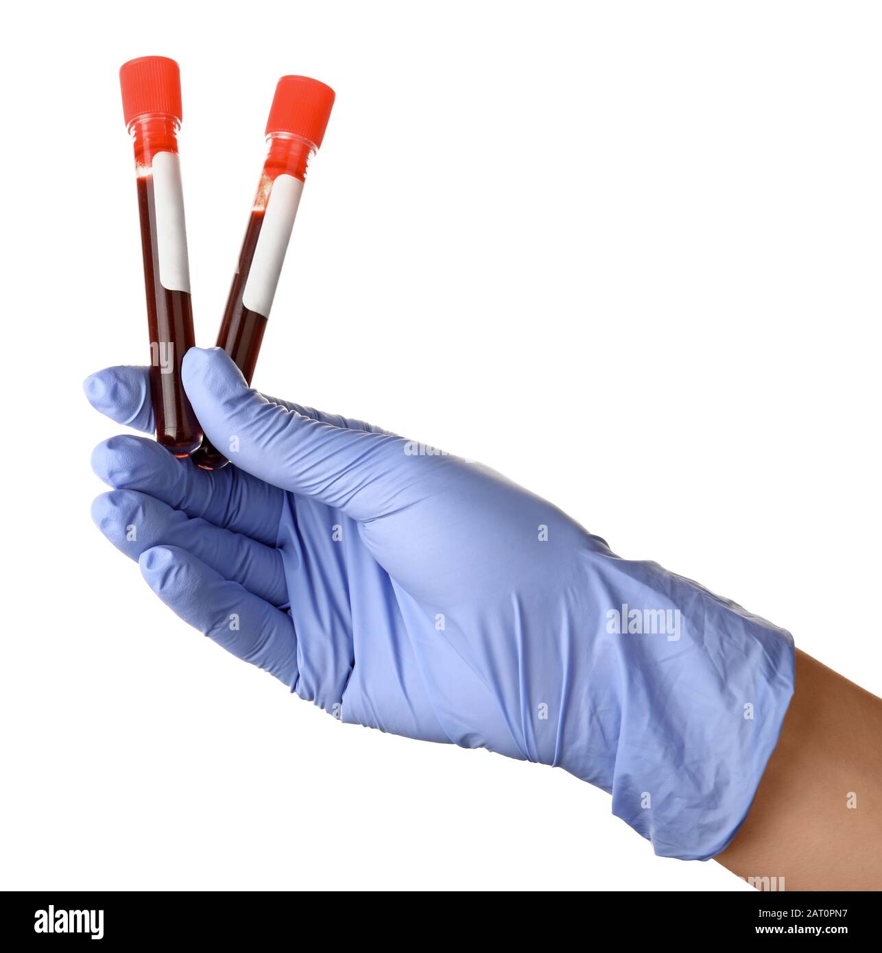 Doctor's hand holding test tubes with blood on white background Stock ...
