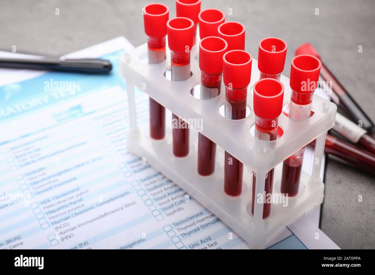 Laboratory test form and blood samples on table Stock Photo - Alamy