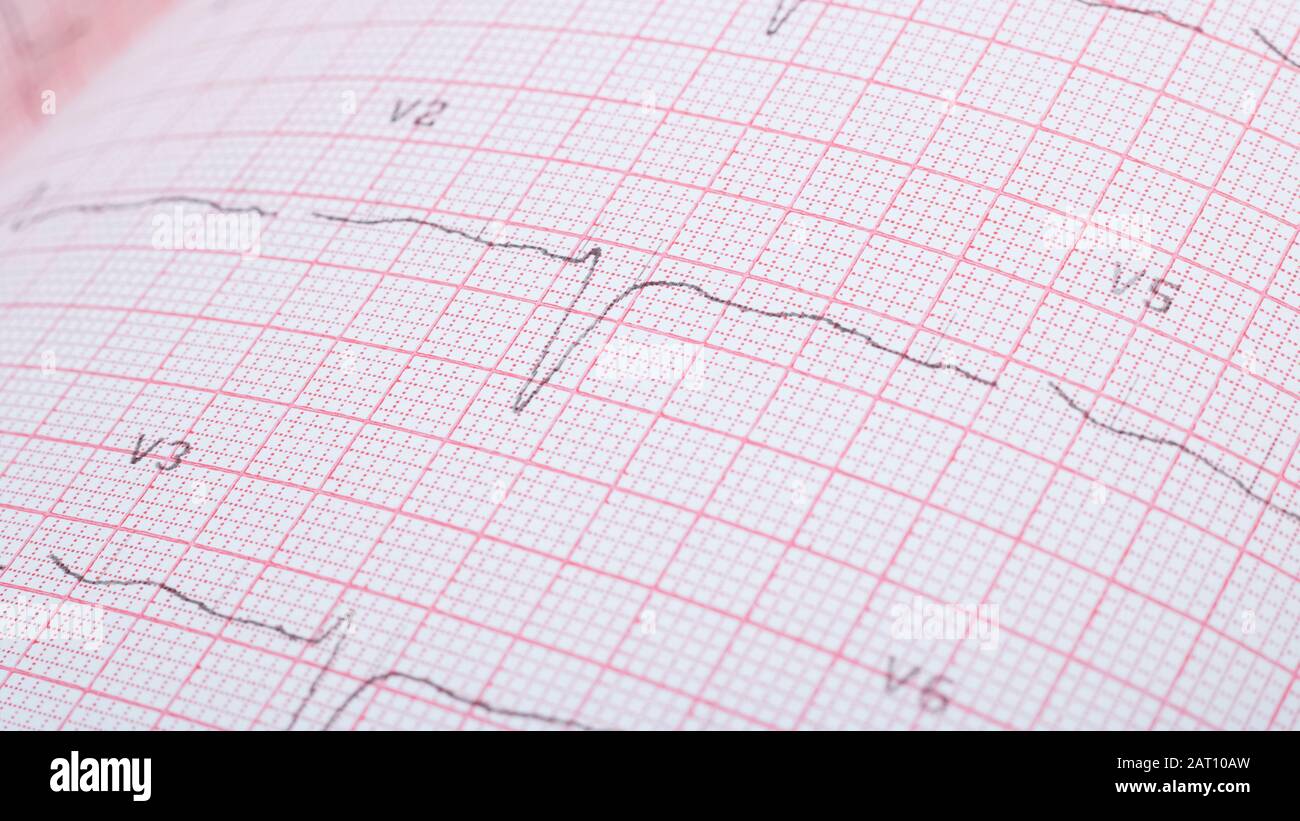 Cardiogram lines on pink paper close up Stock Photo - Alamy