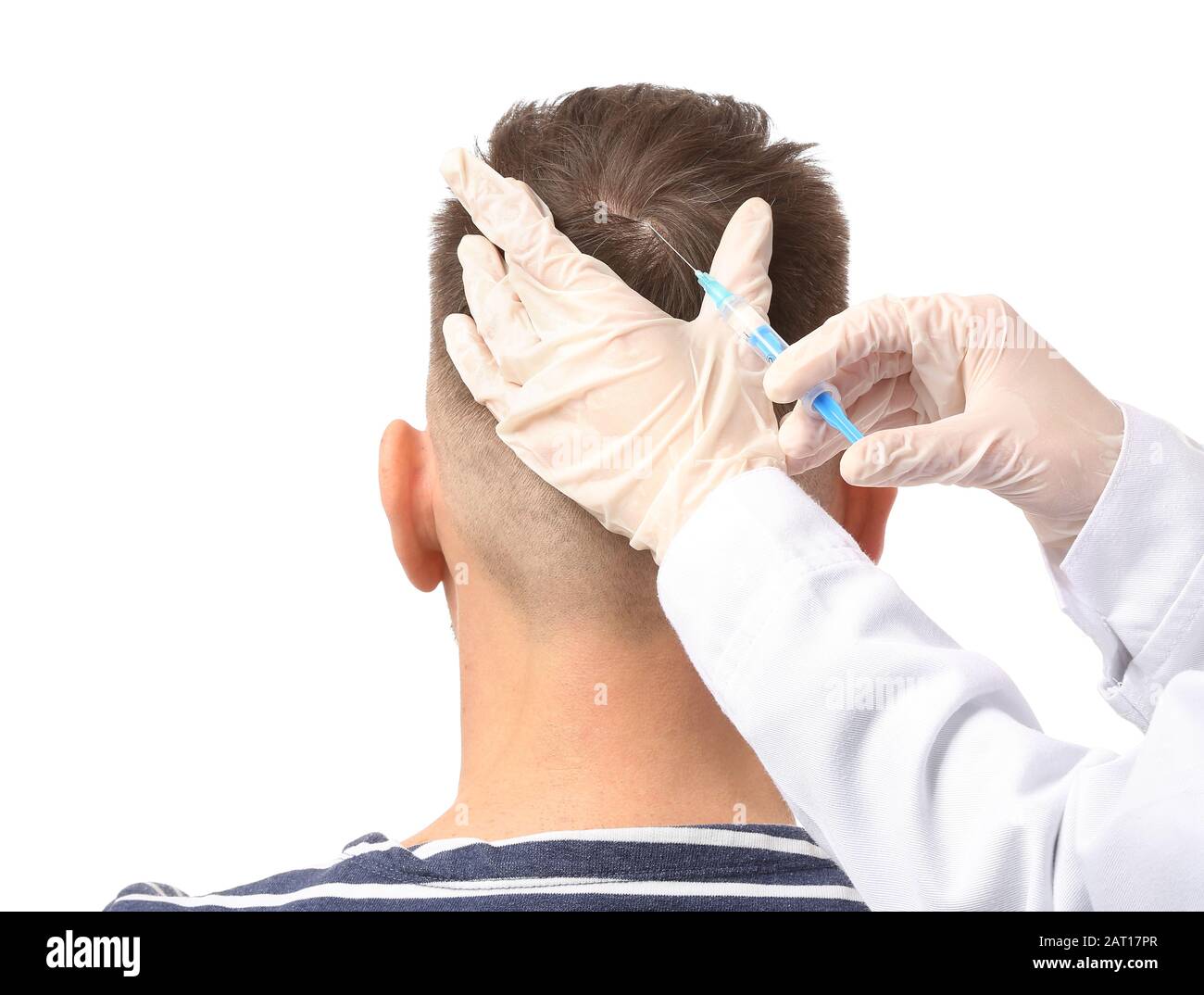 Man with hair loss problem receiving injection on white background ...