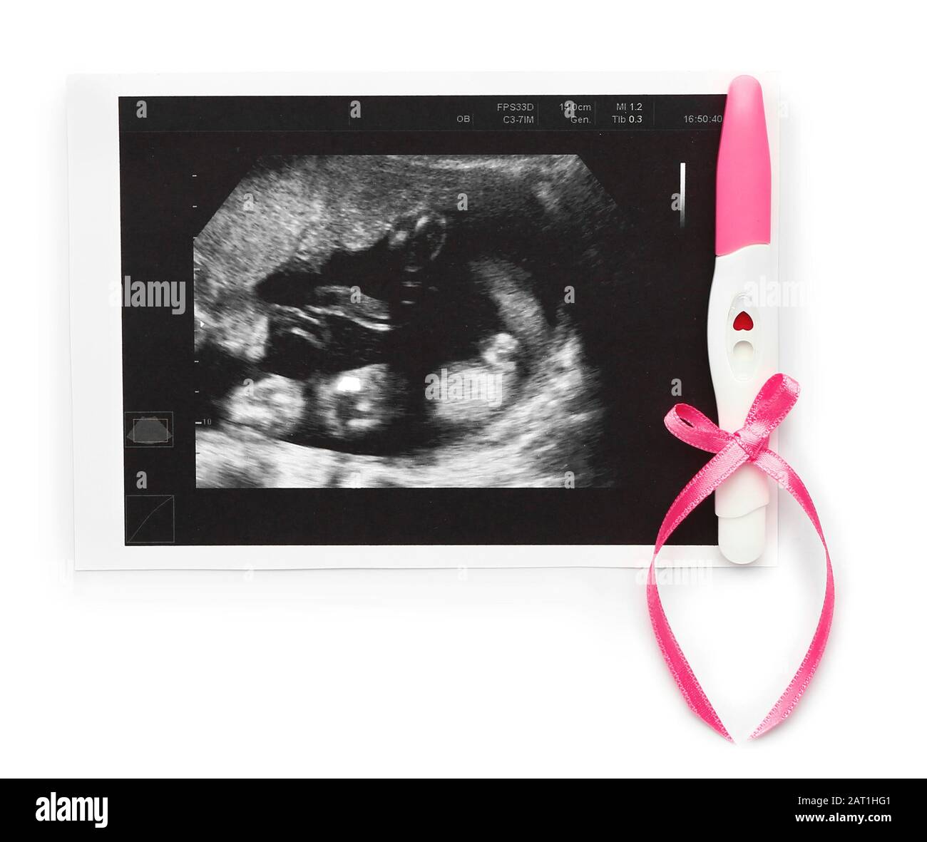 Pregnancy test and sonogram image on white background Stock Photo - Alamy
