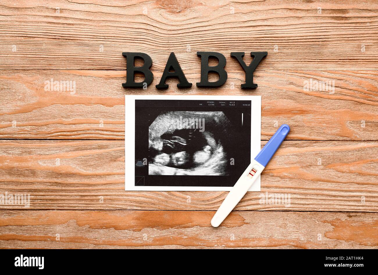 Ultrasound test pregnancy top hi-res stock photography and images - Alamy