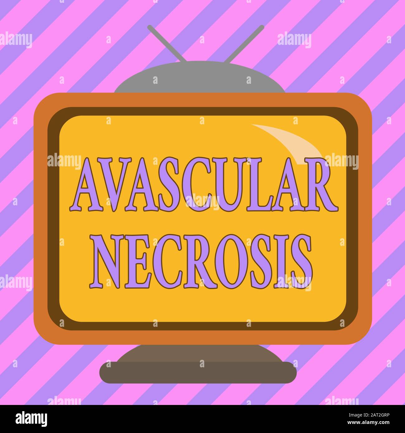 Text sign showing Avascular Necrosis. Business photo showcasing death ...