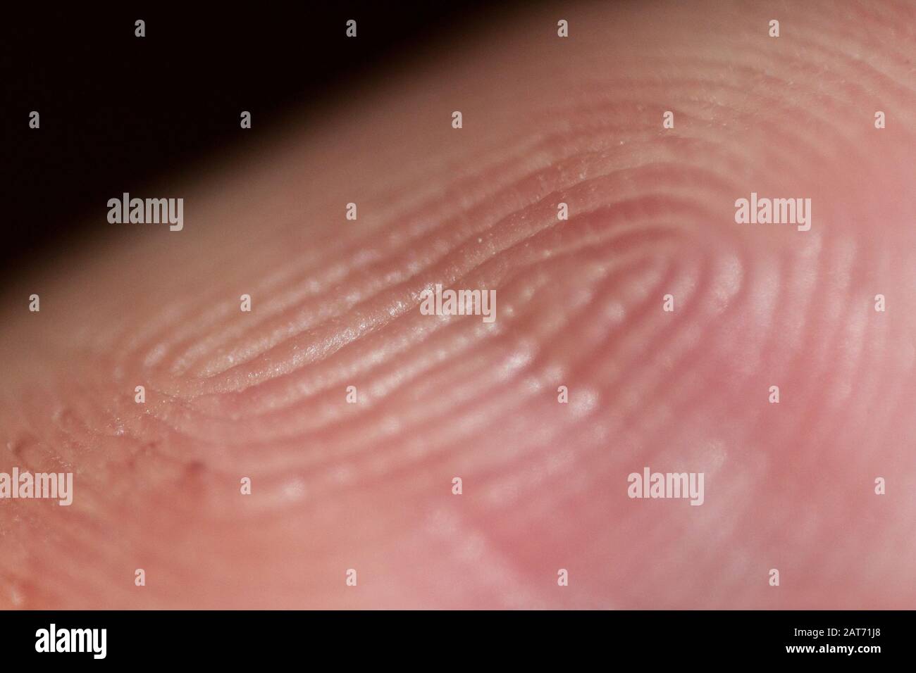 Epidermal Ridges Model
