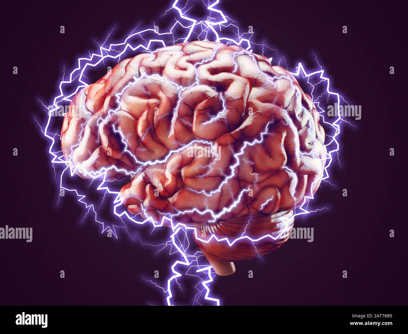 3d Illustration of human brain with lightnings isolated, brainstorm ...