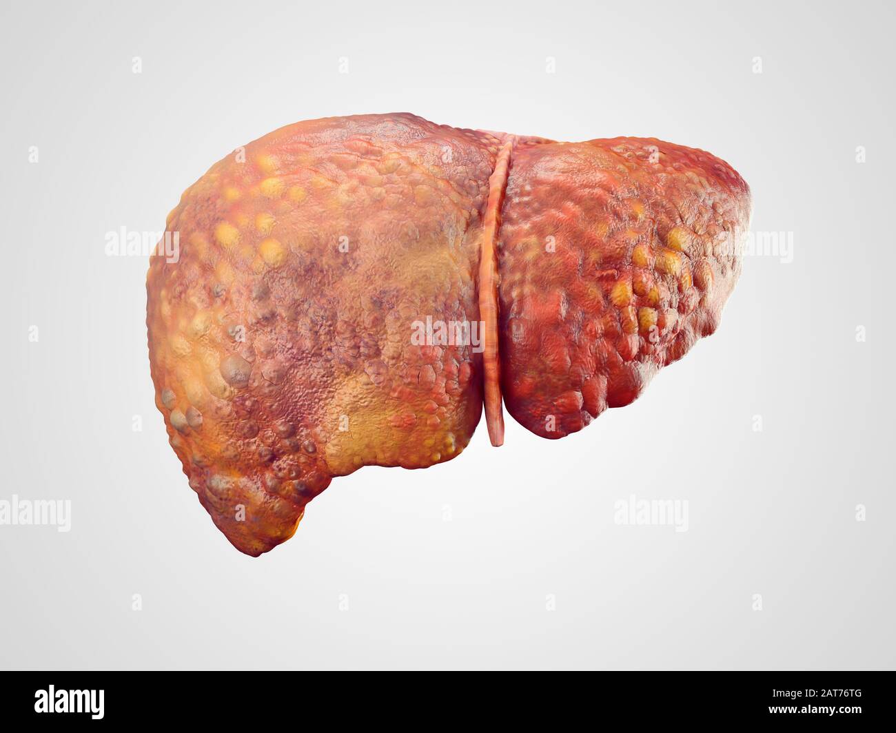 Real Liver