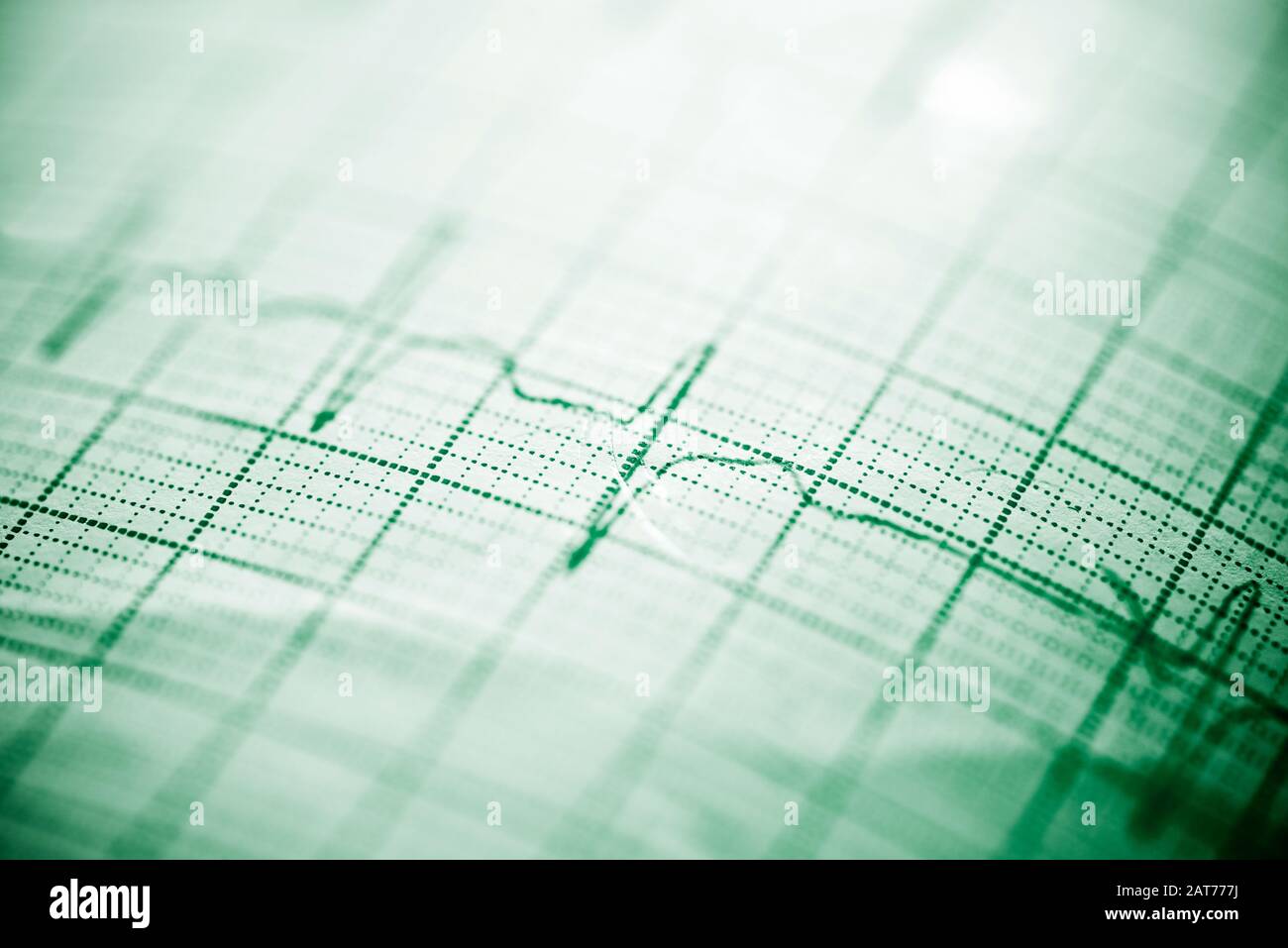 Close up of an electrocardiogram in paper form Stock Photo - Alamy