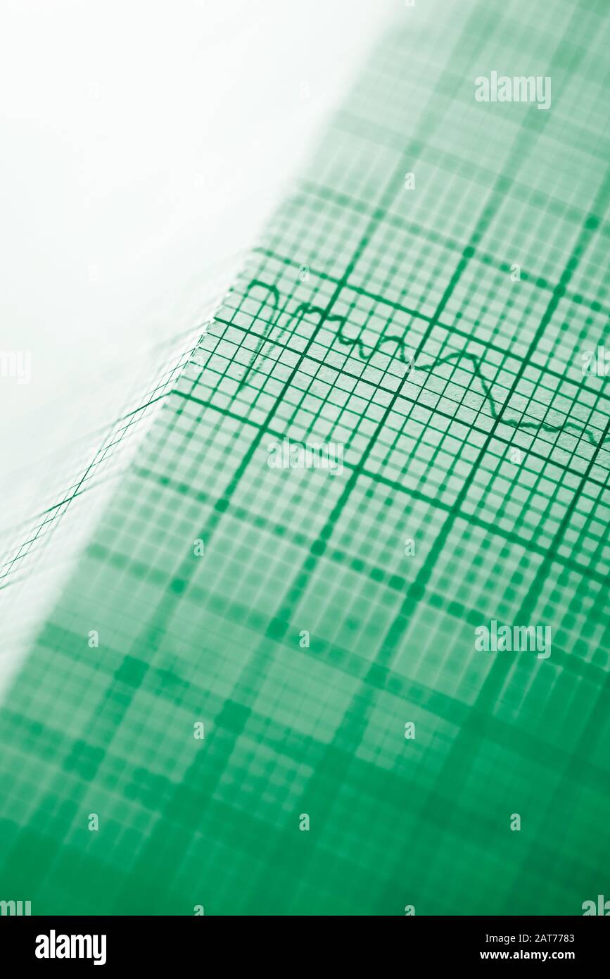 Close up of an electrocardiogram in paper form Stock Photo - Alamy