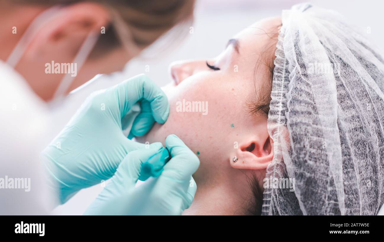 The female beautician doctor making injection in young woman face. The ...