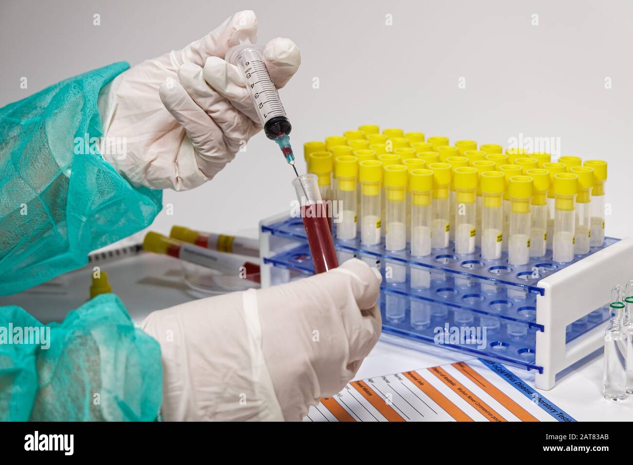 Wuhan Coronavirus COVID-19 2019-nCoV tests on microbiology lab. Chemist ...