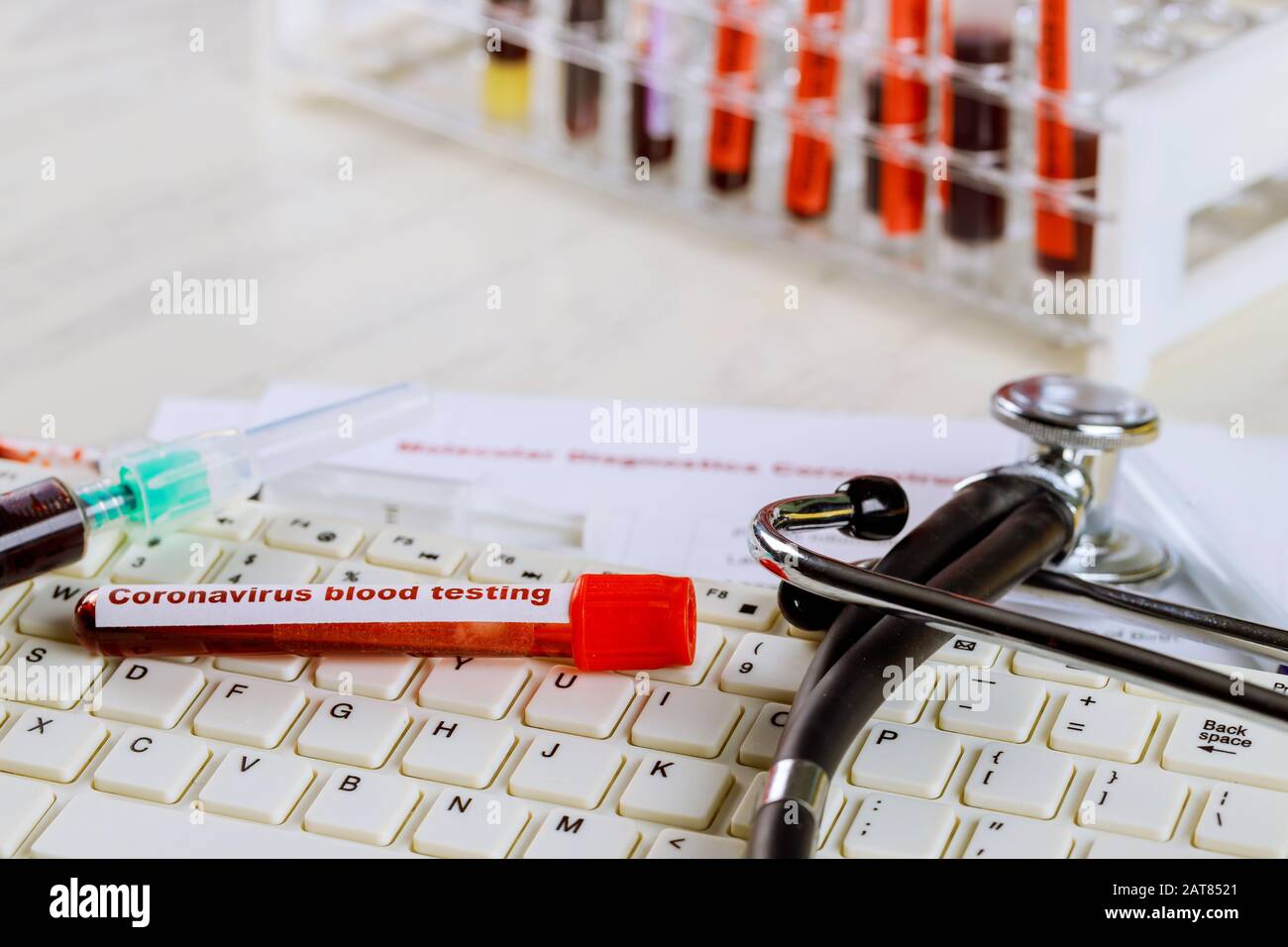 Blood in laboratory test sample in collection tube with laboratory ...