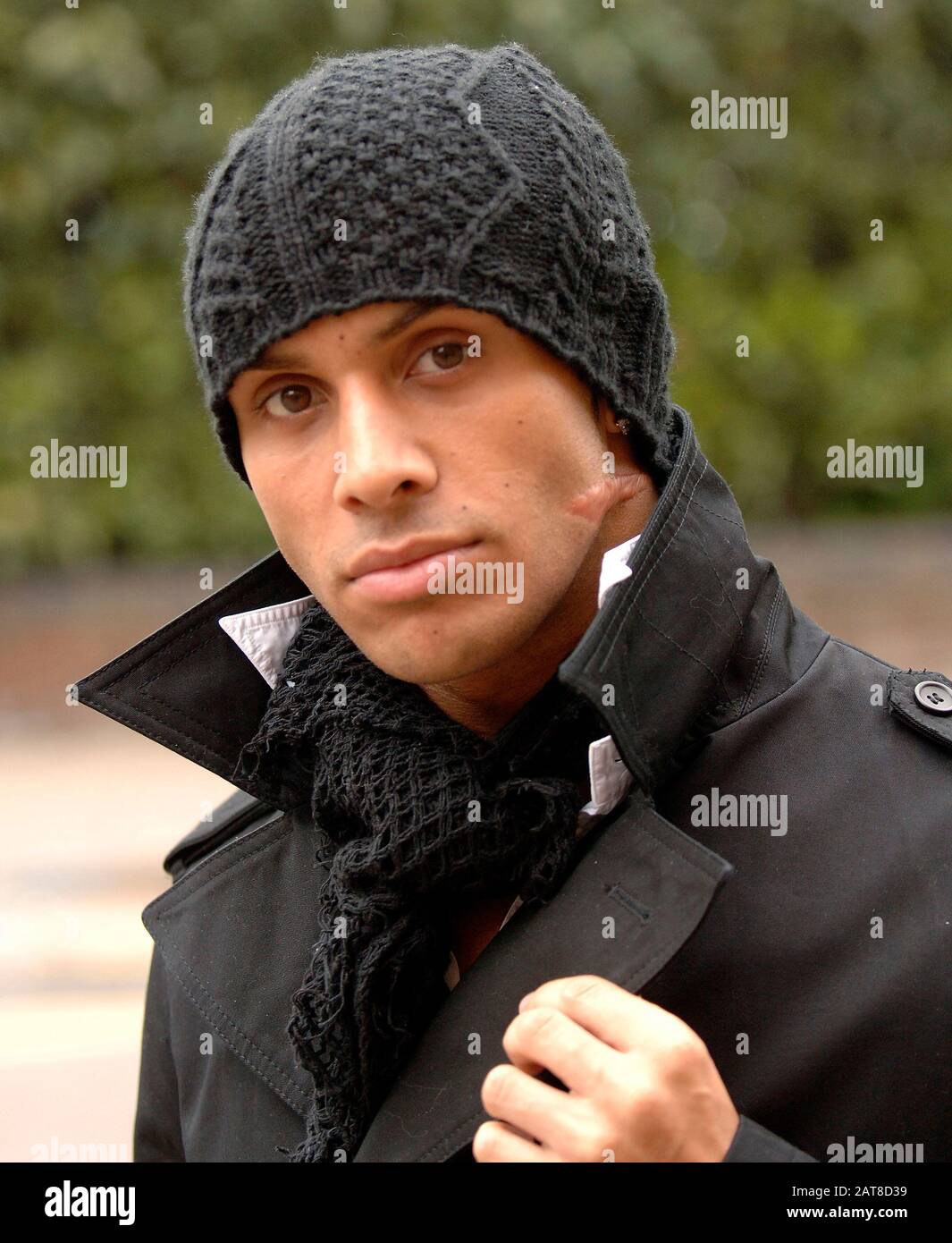 English rock singer Jerome Simeon displaying the scar on his neck ...