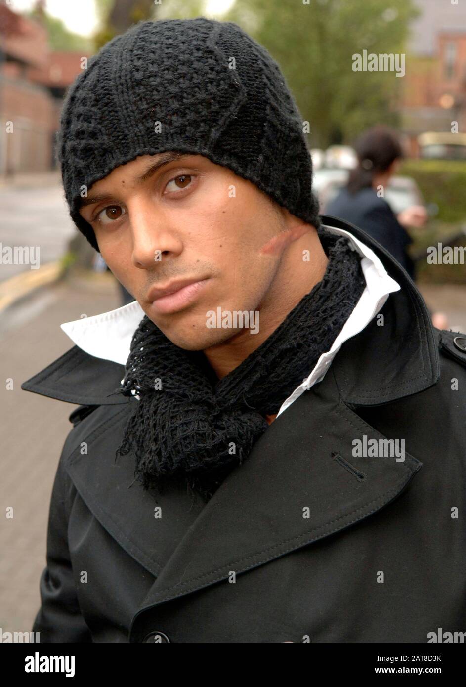 English rock singer Jerome Simeon displaying the scar on his neck ...
